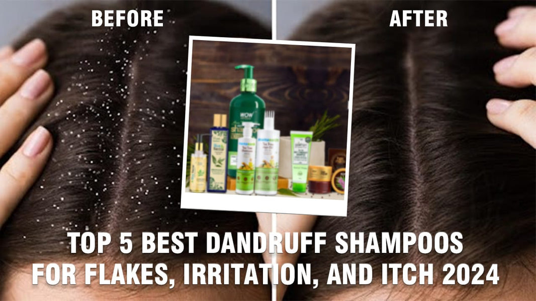 Top 5 Best Dandruff Shampoos for Flakes, Irritation, and Itch 2024 – AZ Hair Vietnam